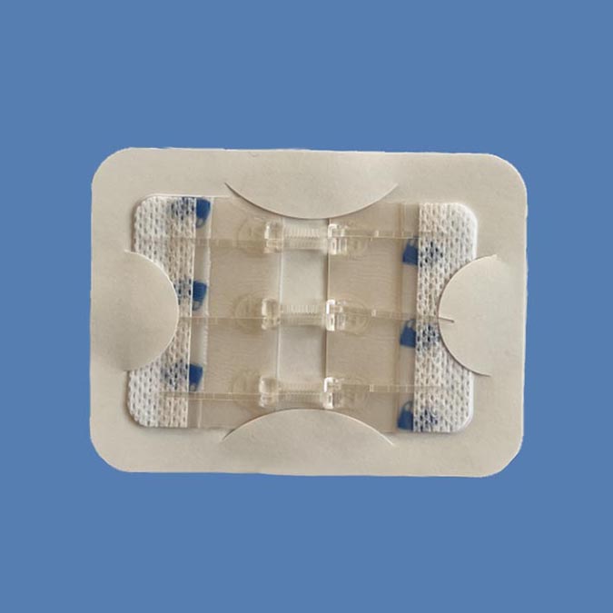 Wound Closure Device/Skin Staplers