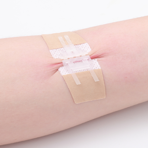 Wound Closure Device/Skin Staplers