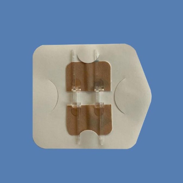 Wound Closure Device/Skin Staplers