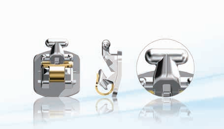 Lingual Self-Ligating Brackets