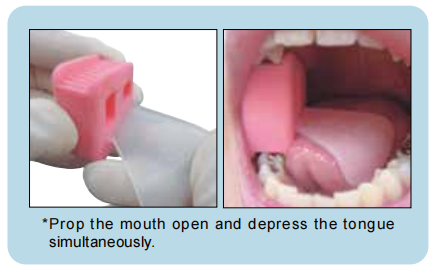 Mouth Prop with Tongue Guard