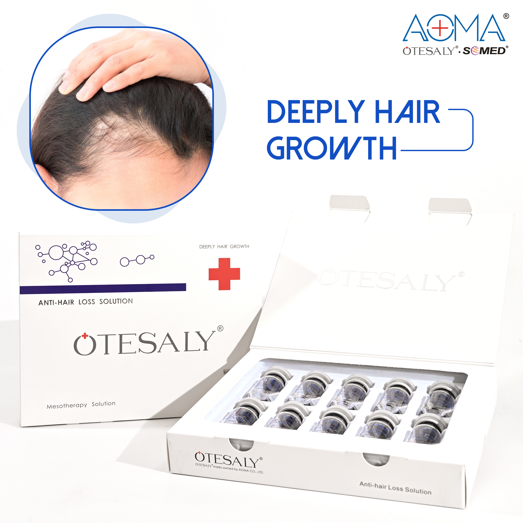 OTESALY® Anti-hair Loss Solution OEM Mesotherapy Solution Hair Rrgrowth ...