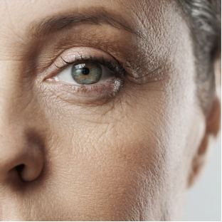 What Is Recombinant Type III Humanized Collagen?
