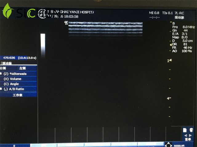 GE 7L-RC Medical Instrument Linear Array Ultrasound Transducer/Probe