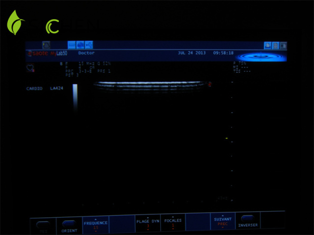 Biosound Esaote LA424 Linear Array Ultrasound Transducer