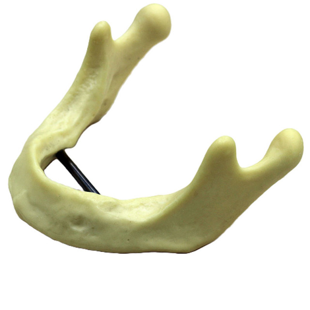 Lower Jaw Mandibular Model - Realistic Resin Bone for Dental Implant ...