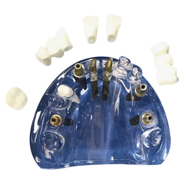 Dental Implant Model Implant and Abutment Demonstration