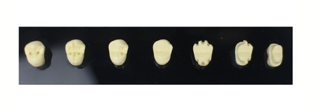 Full Crown Preparation Dental Model with Electric Handpiece