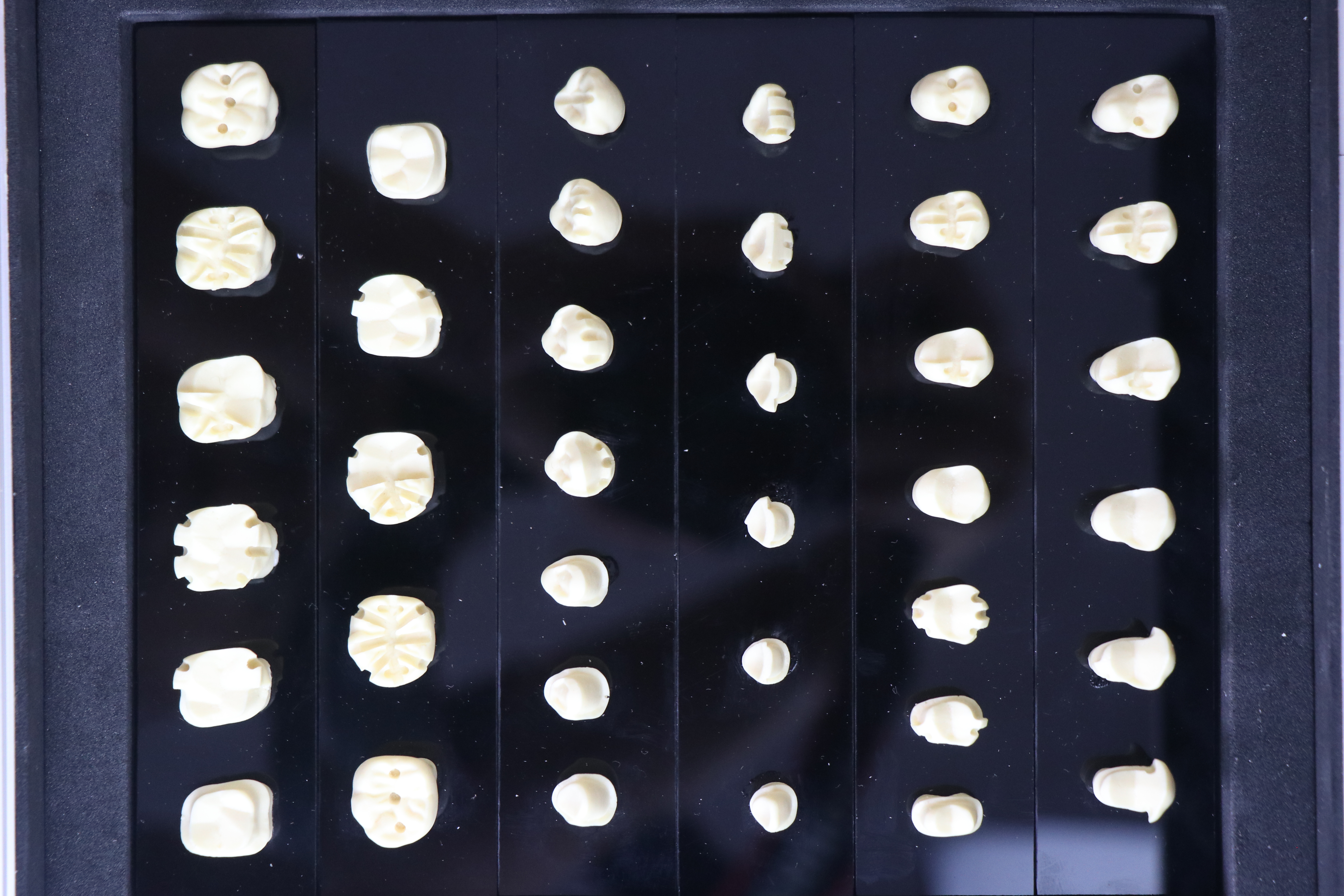 1.5x Enlarged Tooth Preparation Demonstration Model (For Dental Training)