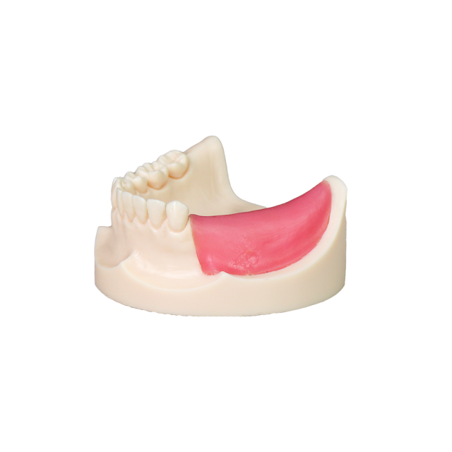 Implant Model