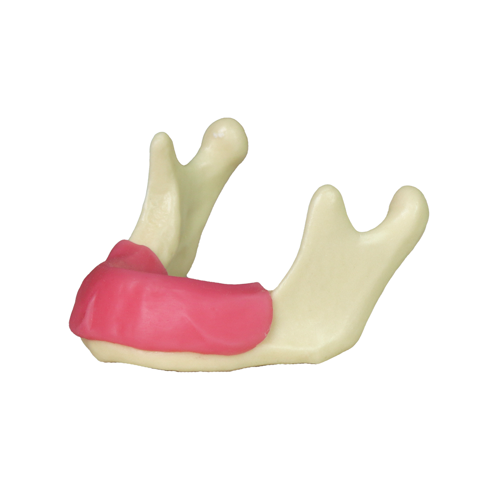 Mandibular Dental Implant Model – Foamed Resin for Implant Practice JG ...
