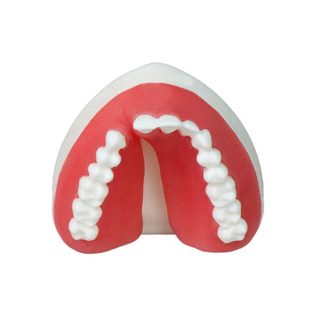 Cleft Lip and Palate Model JG-YC – Medical Demonstration for Patient ...