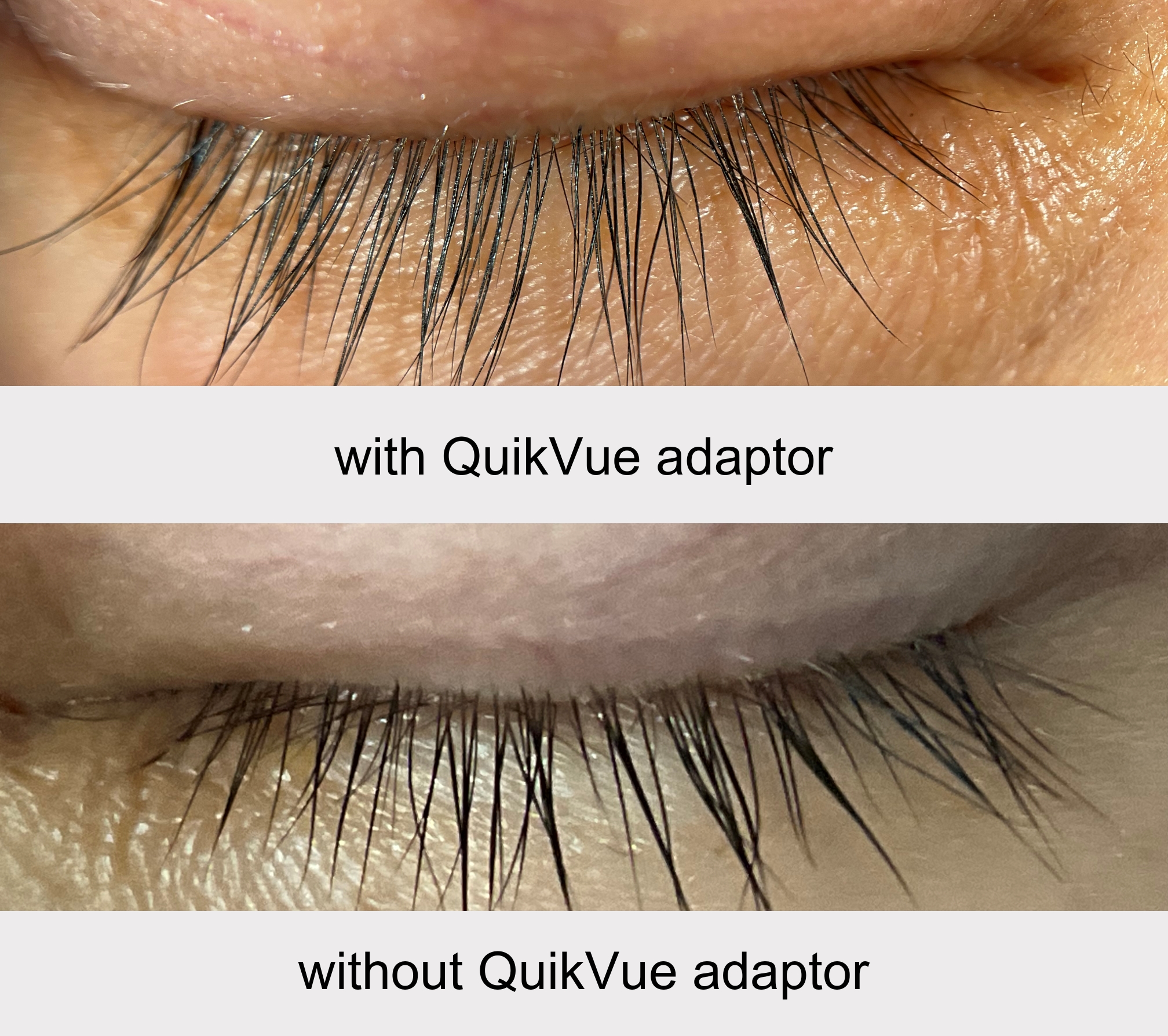 How to check Blepharitis with a tablet and QuikVue eye imaging adaptor