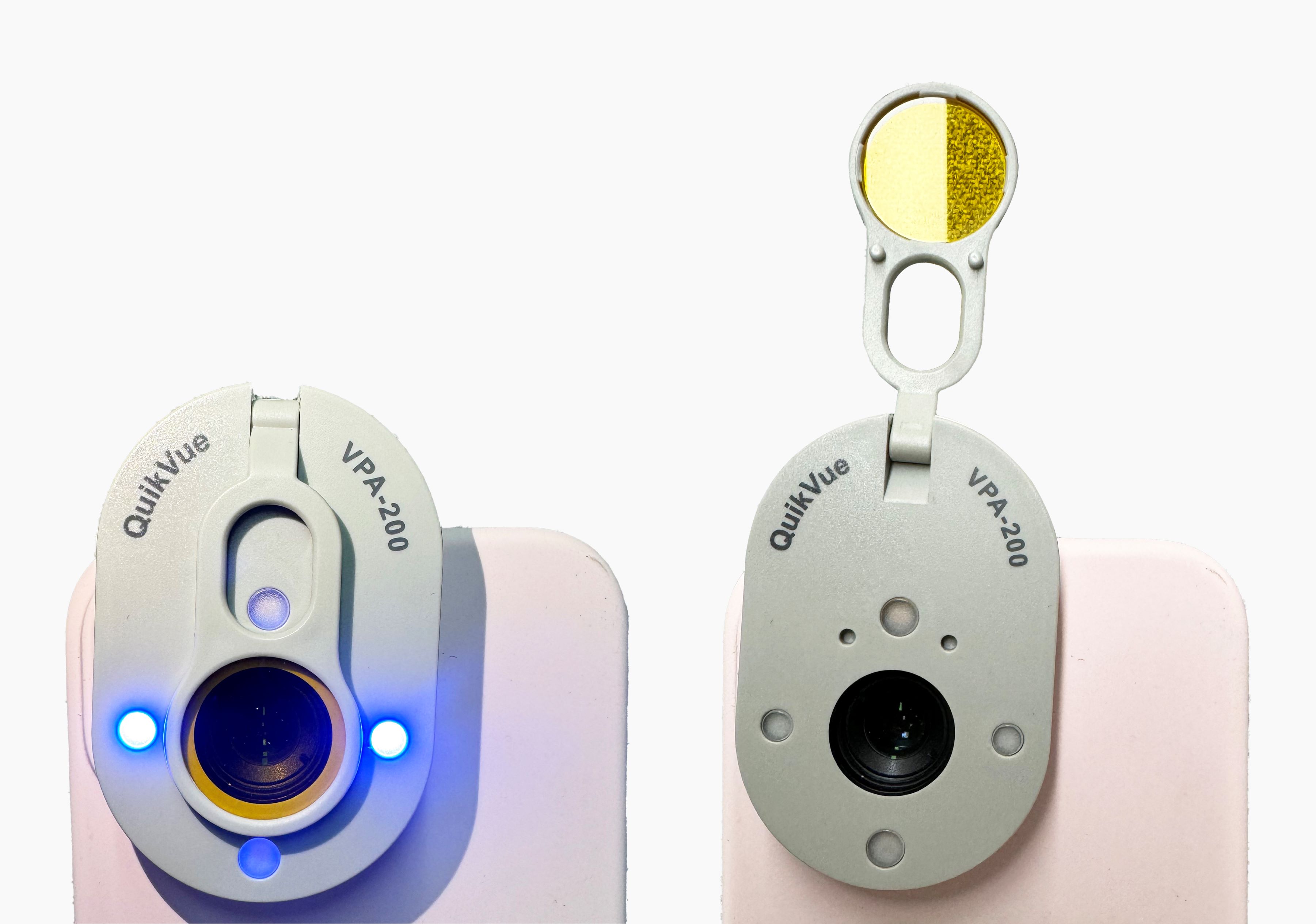 OK Lens Fitting with a QuikVue smartphone eye imaging Adaptor