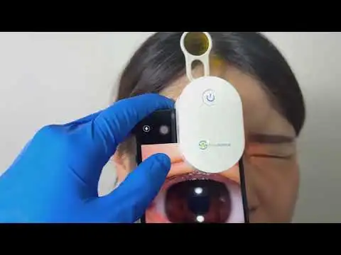 Eye Imaging Adaptor QuikVue Plus VPA-200