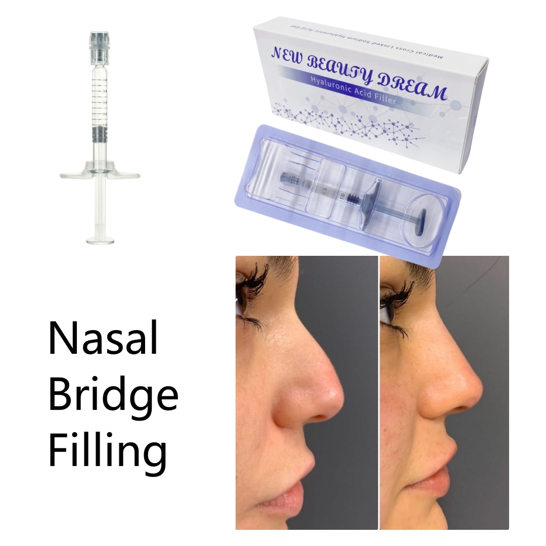 1ml Nose Lift Injectable Hyaluronic Acid Dermal Filler - Intense ...