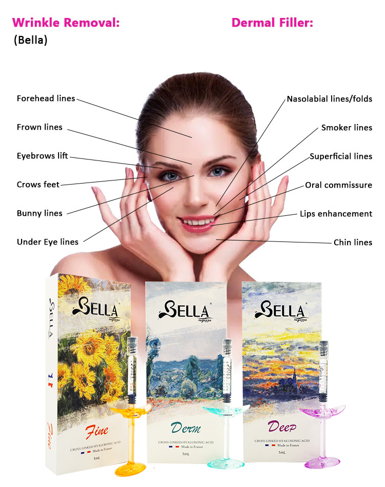The Bella series of hyaluronic acid-based monophasic dermal fillers has ...