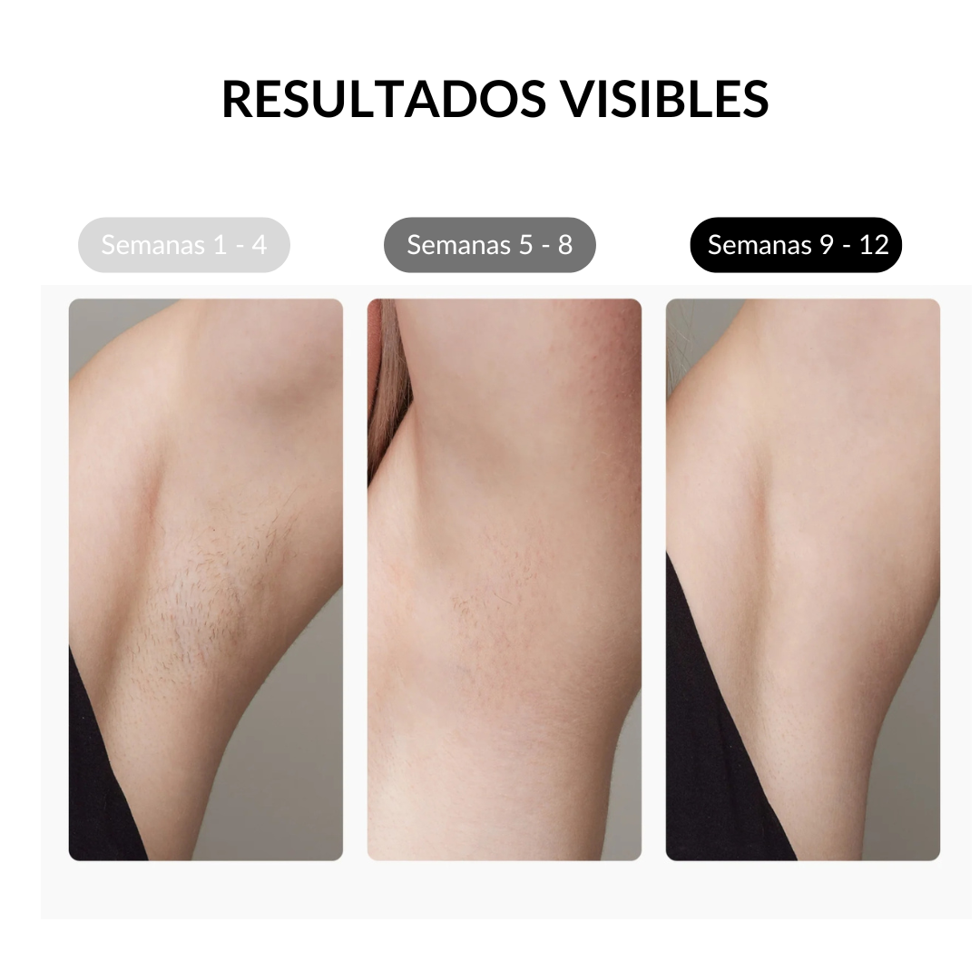 FENUS Depiladora Láser Permanente-De Luz Pulsada IPL Sin Dolor