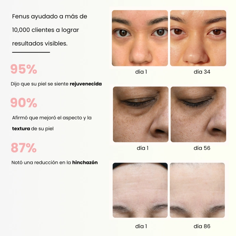 Fenus V1 4-en-1 Dispositivo de Rejuvenecimiento Facial
