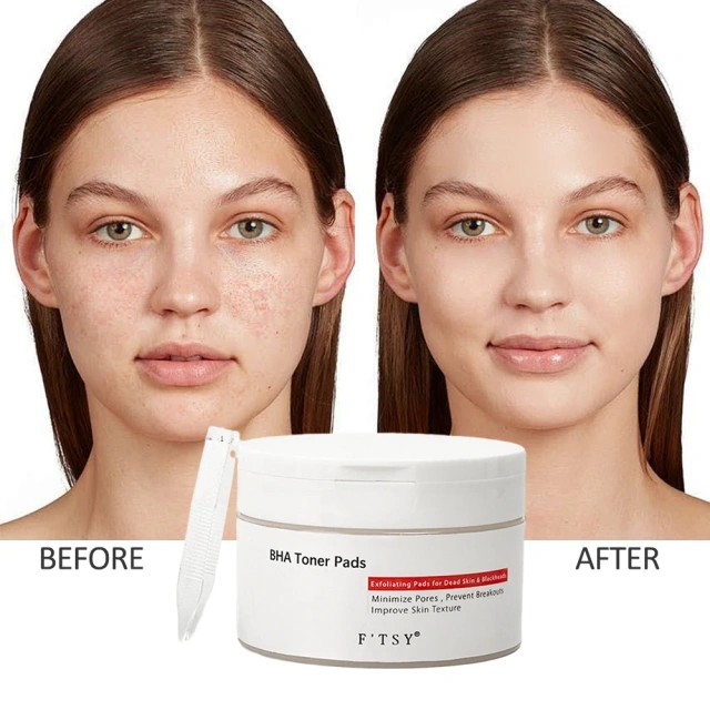 OEM Natural Gentle Exfoliating BHA Toner Pads With Salicylic Acid For ...