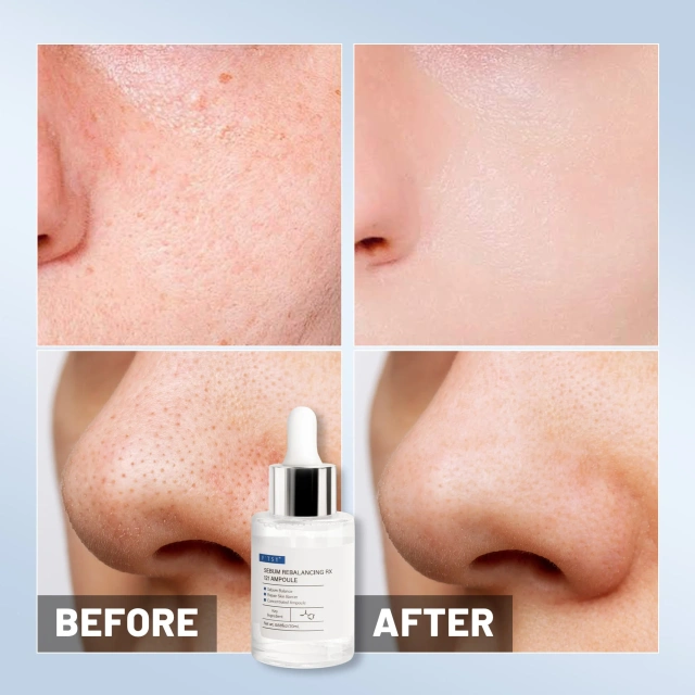 OEM Sebum Rebalancing Rx Ampoule Repair Skin Barrier Skin Care Serum ...