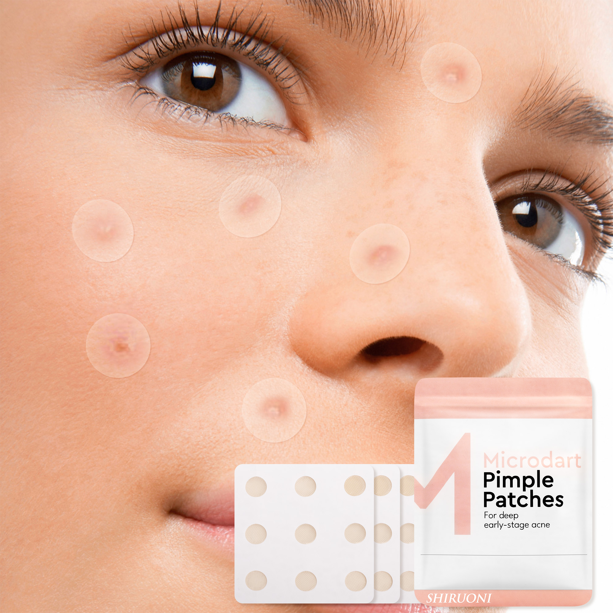 Microneedle Acne Patch – Scar & Pimple Care