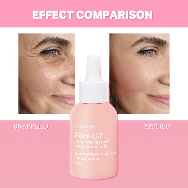 Face Oil OEM Factory | Rosehip & Macadamia Oil | Private Label Skincare