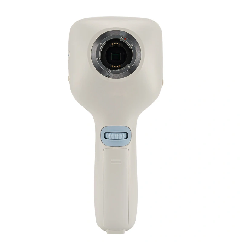 HFC-1 Fundus Camera,Fundus Camera