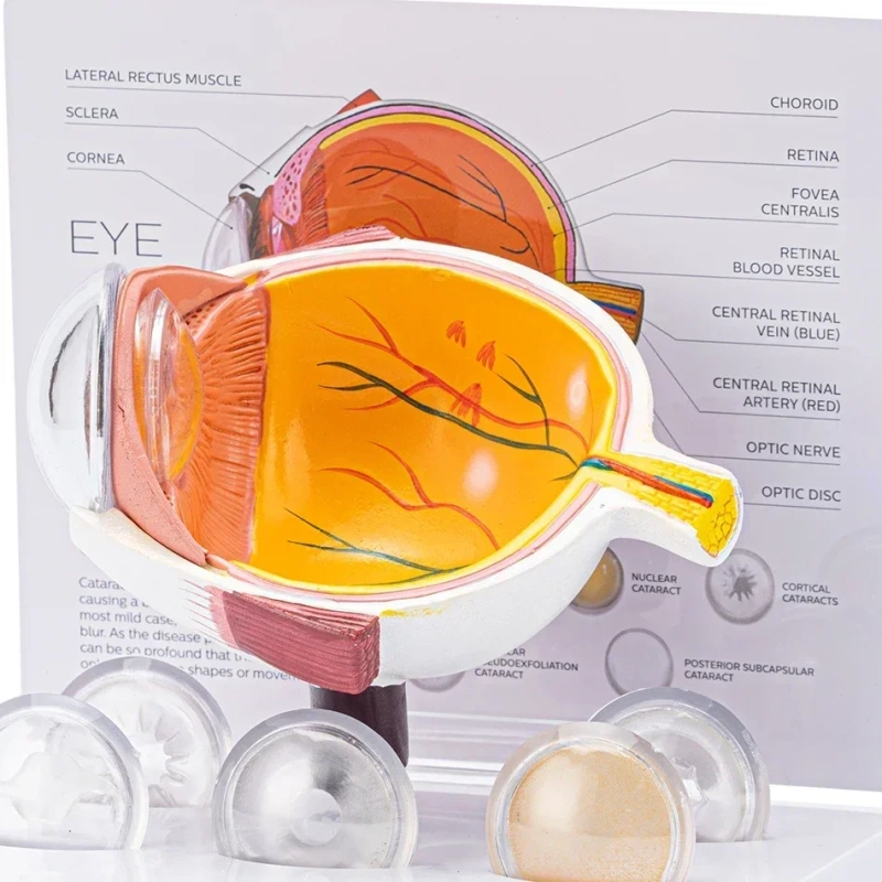 TB-03 Cornea Eyeball Model,Glasses Other Tools