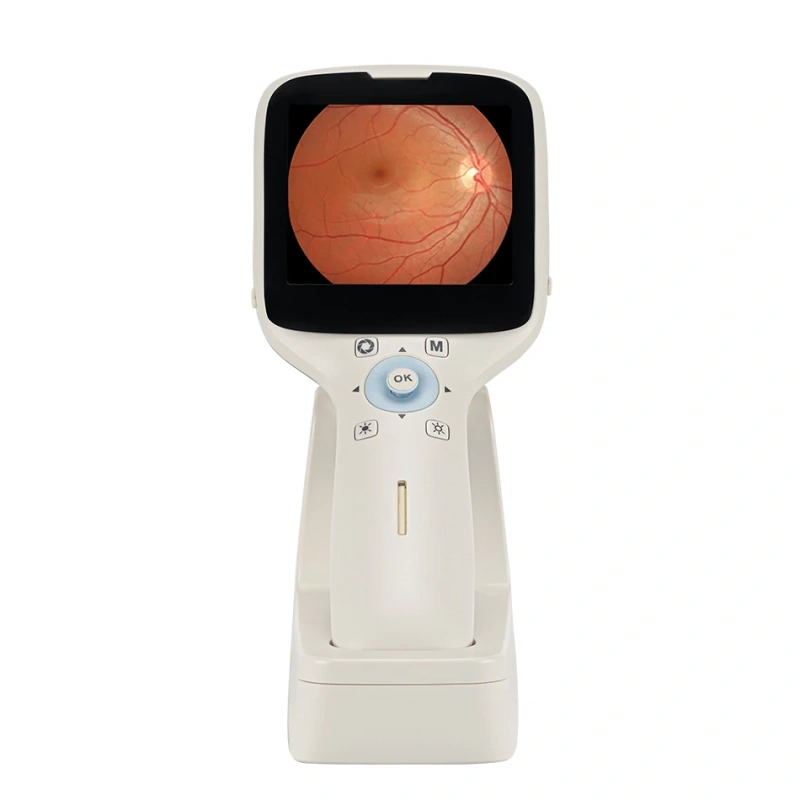 HFC-1 Fundus Camera,Fundus Camera