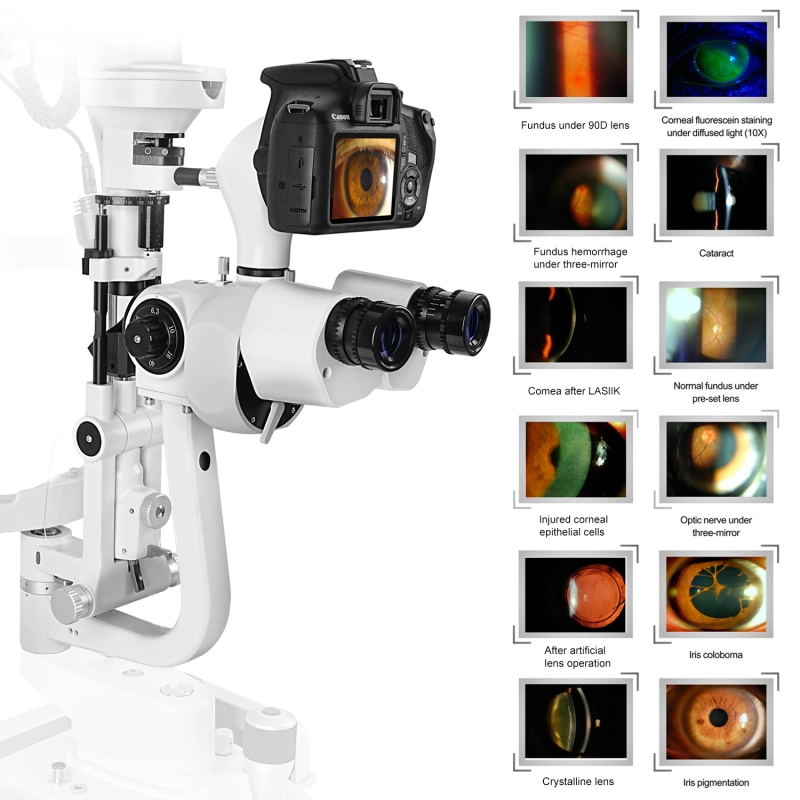 LS-5DX Digital Slit Lamp