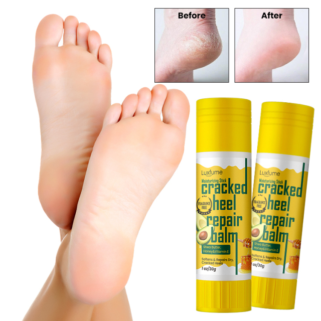Cracked Heel Repair Balm