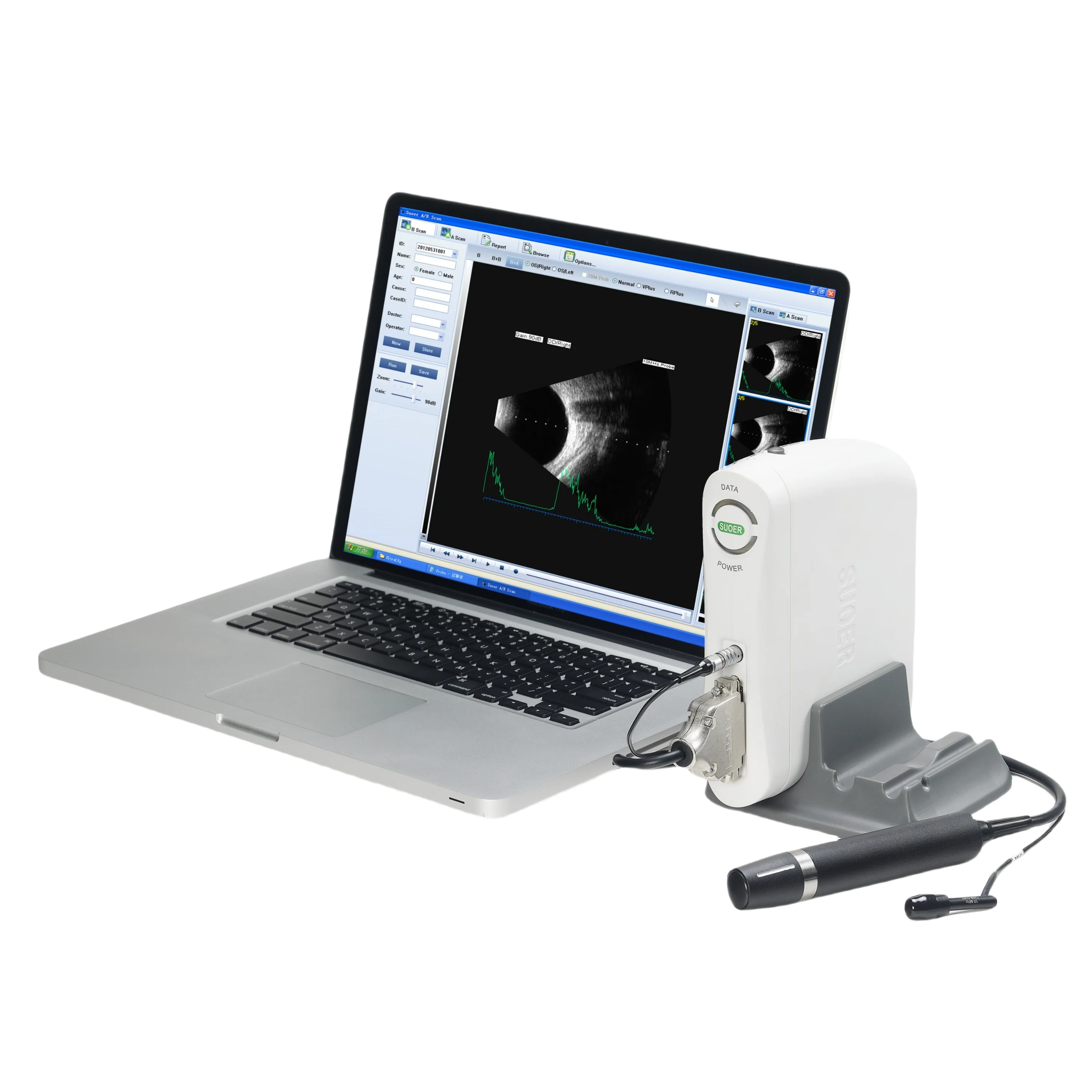 SW-2100 Ophthalmic A/B Scan Ophthalmic Ultrasound AB Scanner Pachymeter ...