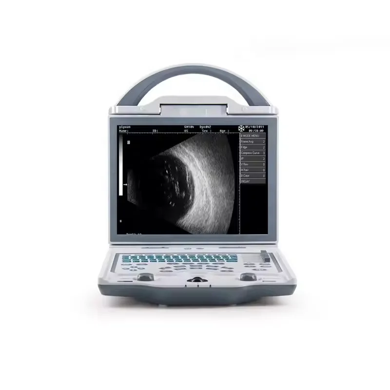 ODU5 Ophthalmic AB Scan Ophthalmic Ultrasound AB Scanner Pachymeter ...