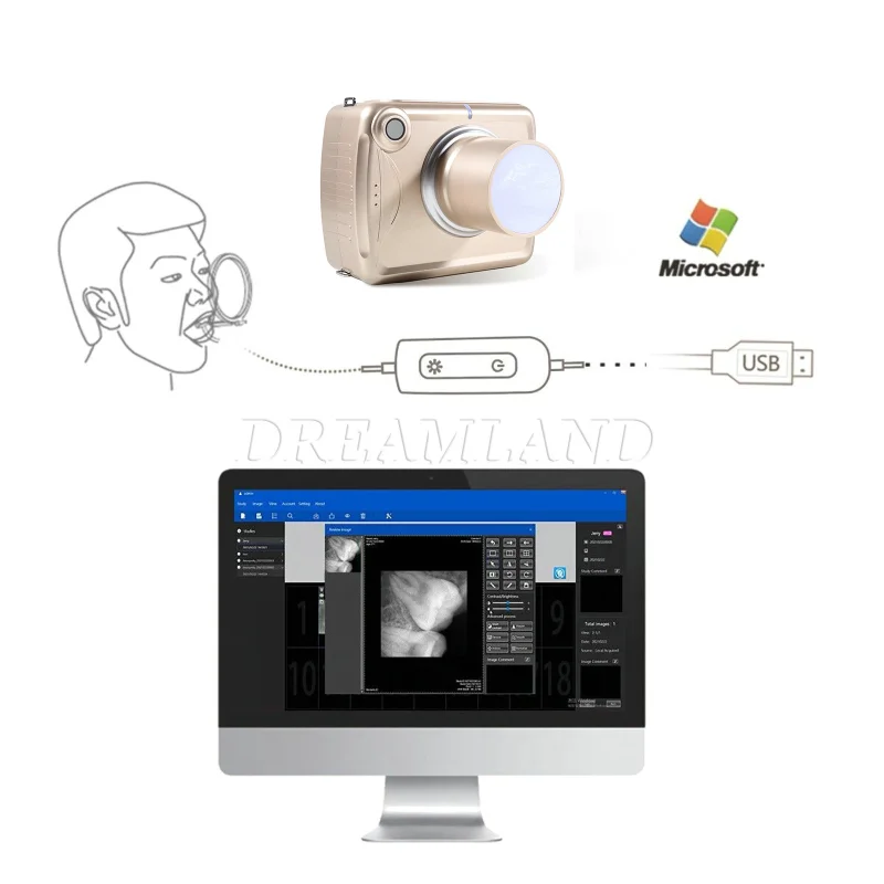 Dental Digital X Ray Sensor Imaging System