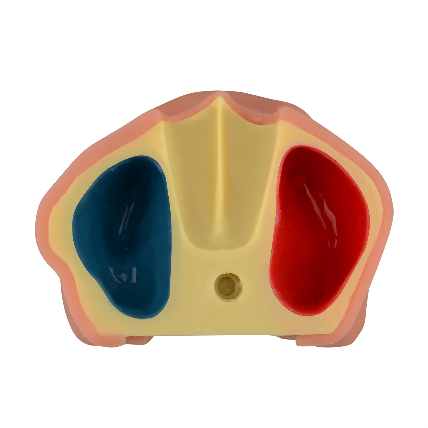 Maxillary Sinus Lift Dental Implant Practice Mode A - Dental Teeth ...