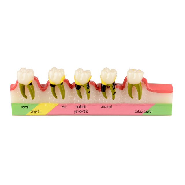 Periodontal Disease Classification Model Manufacturer