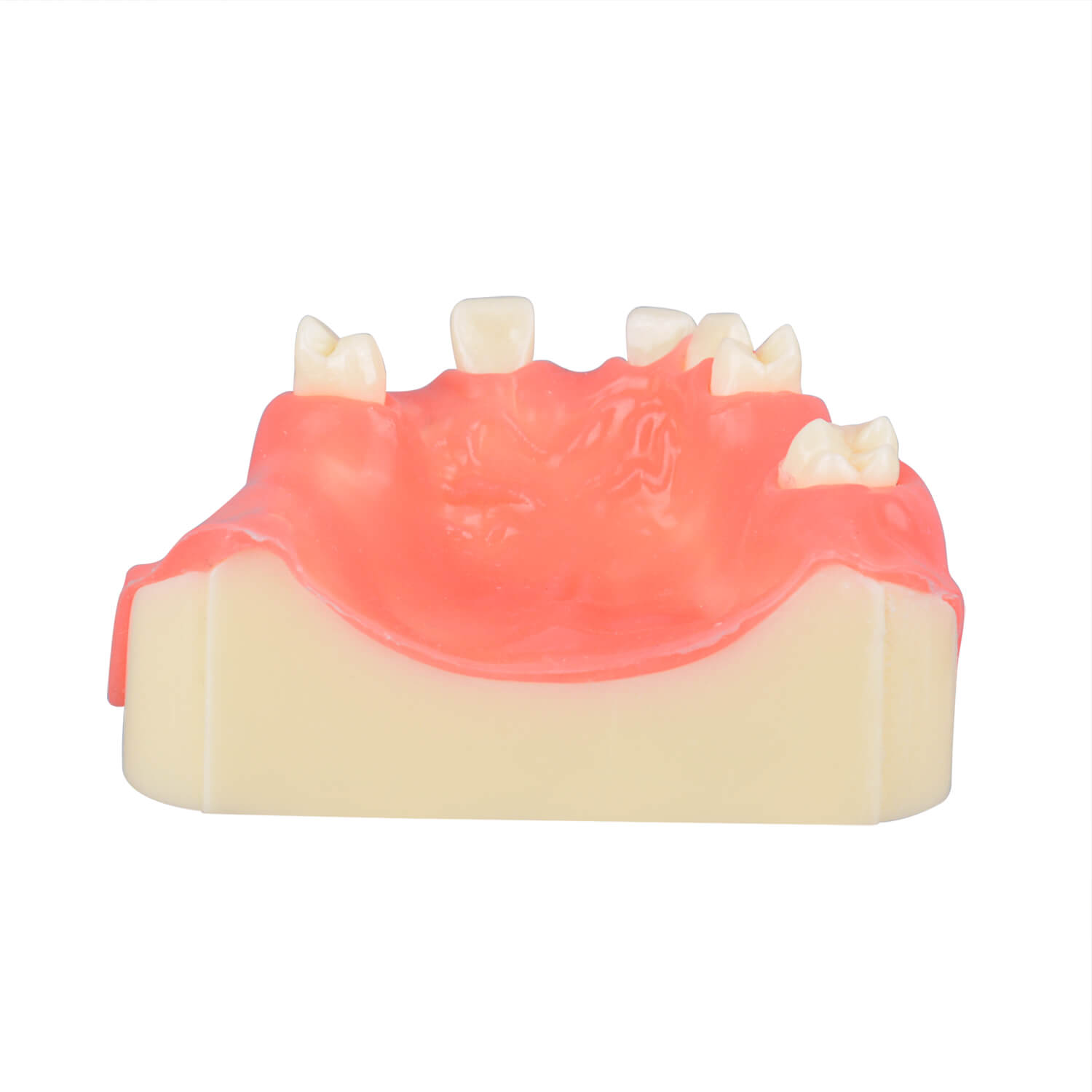 Orthognathic Surgery Maxillary Sinus Lift Training Model, Missing 8 Teeth