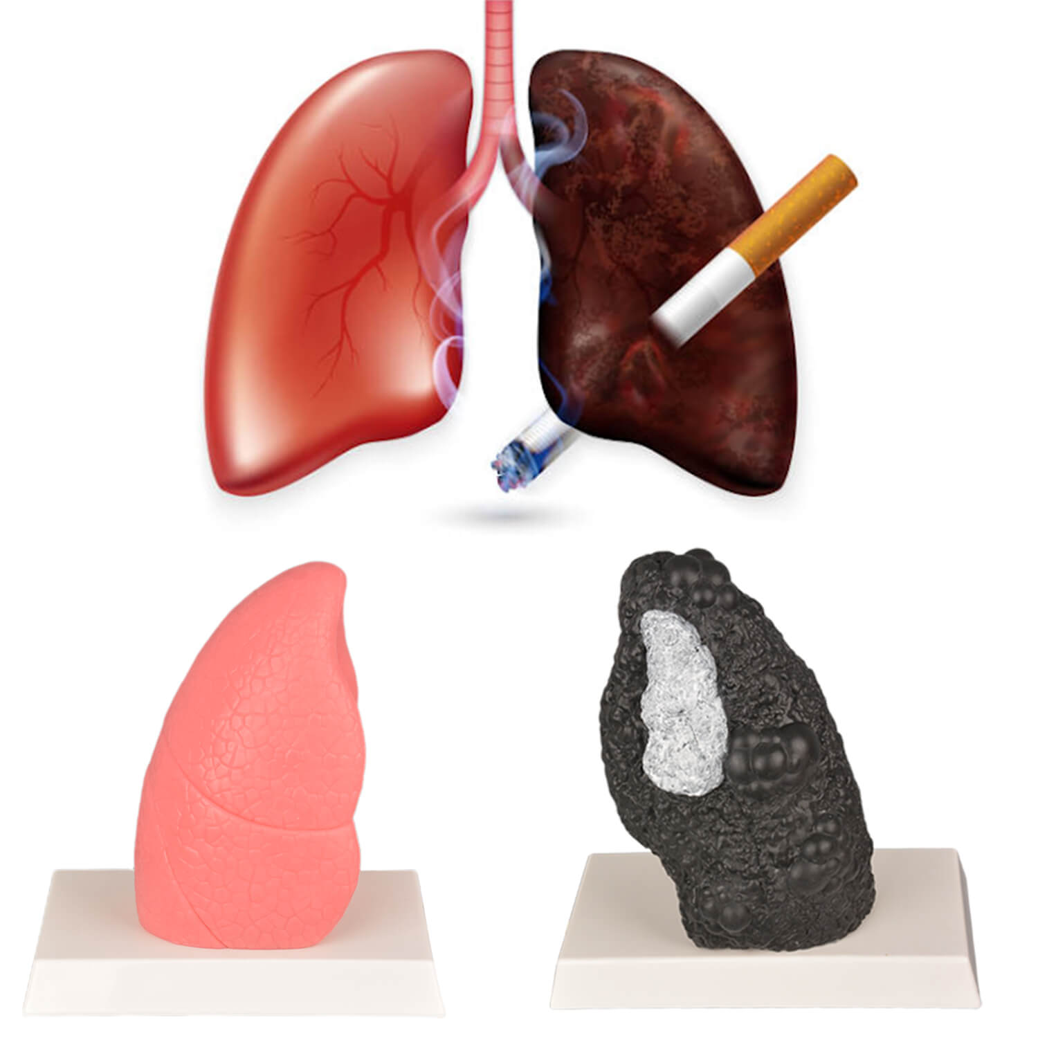 Healthy and Smokers Lung Model, Small and Large Size