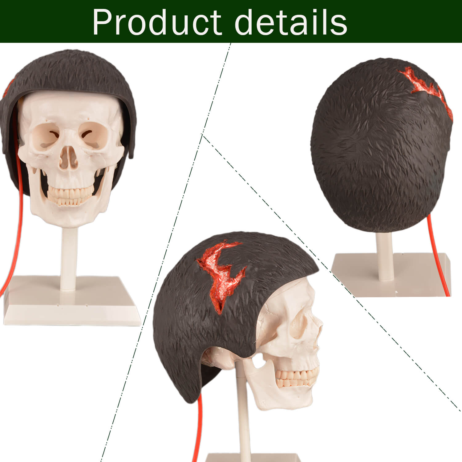Open Scalp Wound Moulage, Brown and Dark Skin