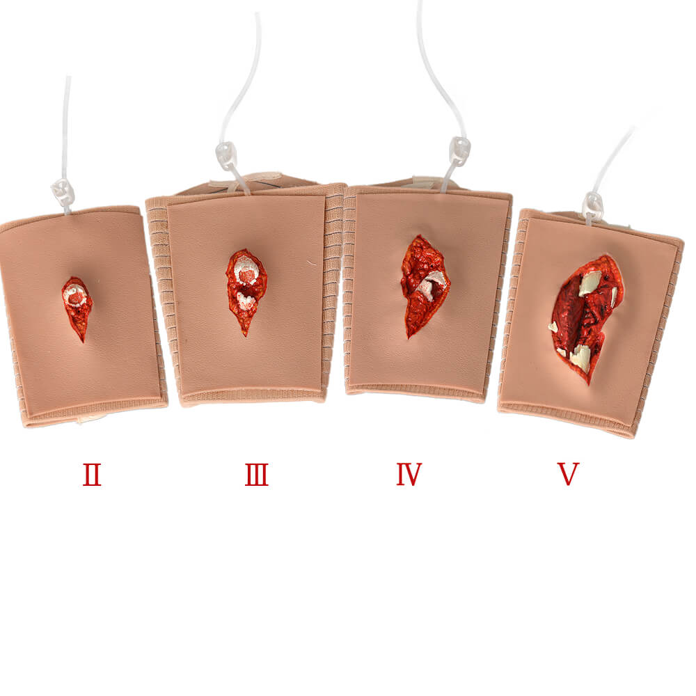 Wearable Open Fracture Wound Packing Trainer, Ⅱ, Ⅲ, Ⅳ, Ⅴ