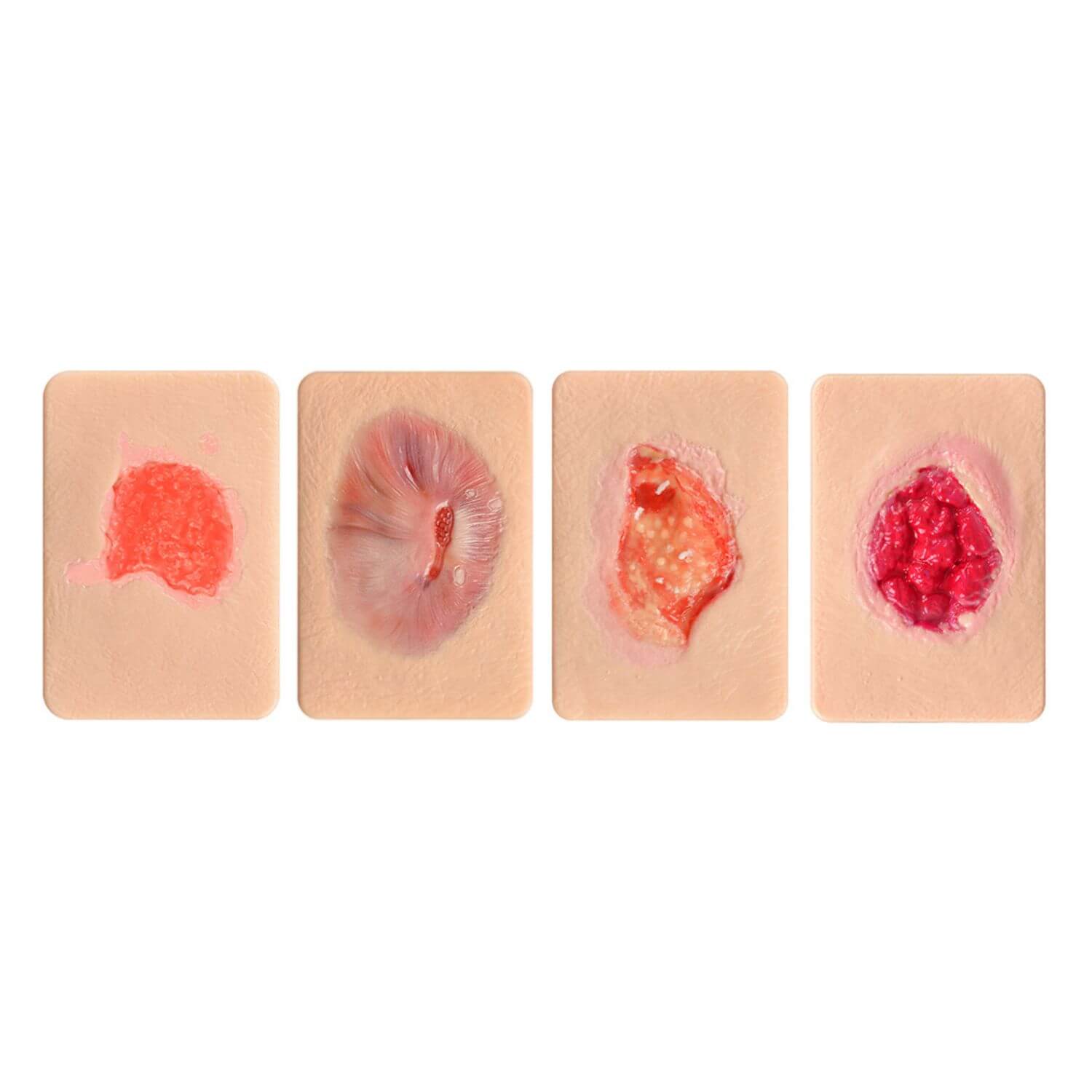 Pocket Granulation Tissue Wound Model Set for Wound Care Education