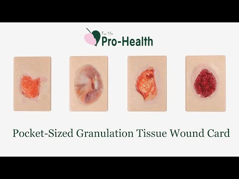 granulating wound photo