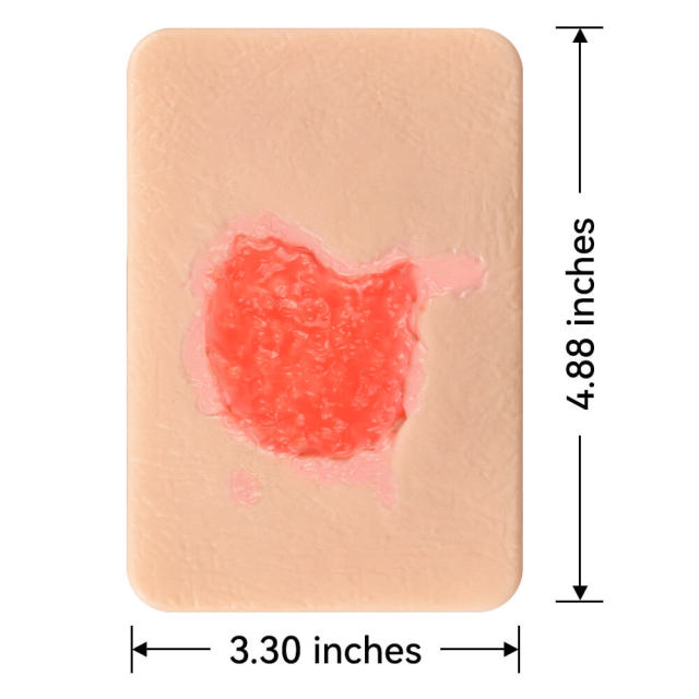 Pocket Granulation Tissue Wound Model Set for Wound Care Education