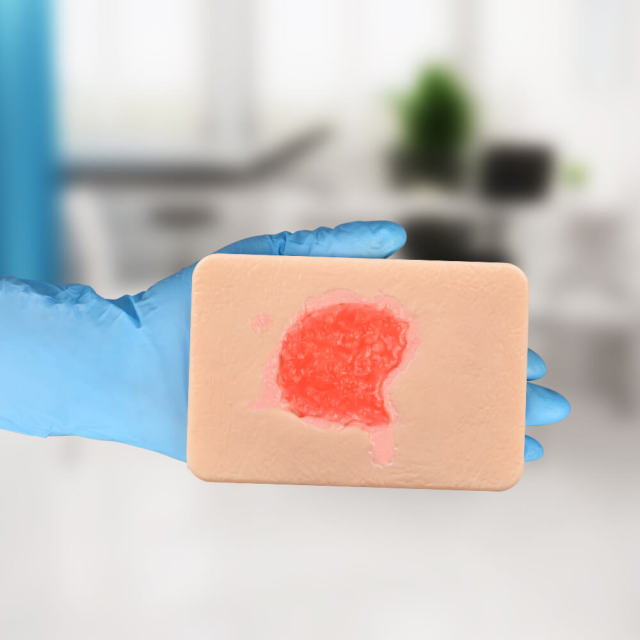 Pocket Granulation Tissue Wound Model Set for Wound Care Education