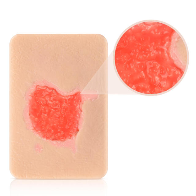 Pocket Granulation Tissue Wound Model Set for Wound Care Education
