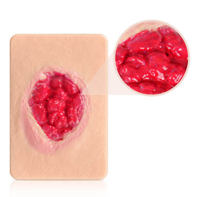 Pocket Granulation Tissue Wound Model Set for Wound Care Education