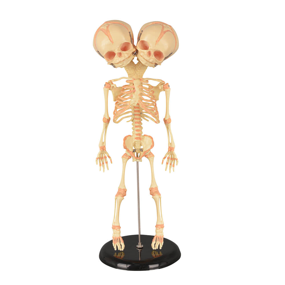 Mini Infant Skeleton Model with Double Skulls