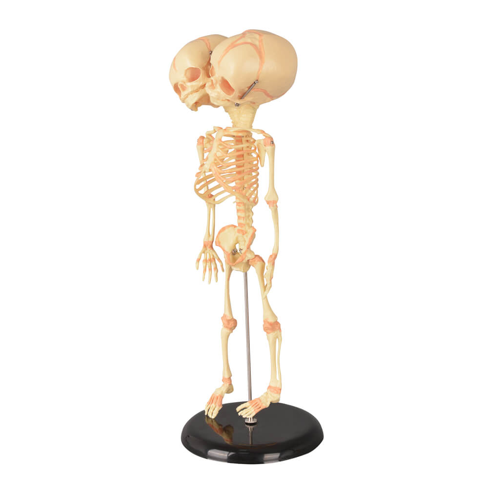 Mini Infant Skeleton Model with Double Skulls