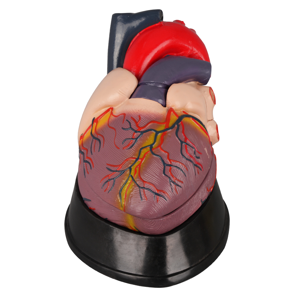 Medical Plastic Human Heart Model - Jumbo Anatomical Heart for Study